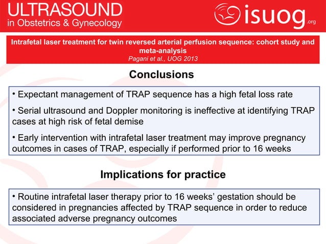 UOG Journal Club: Intrafetal laser treatment for twin reversed arterial ...