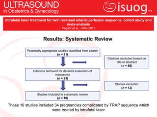 UOG Journal Club: Intrafetal laser treatment for twin reversed arterial ...