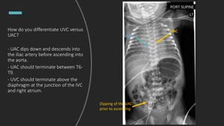 CMC Pediatric X-Ray Mastery: 26th Case Series | PPT
