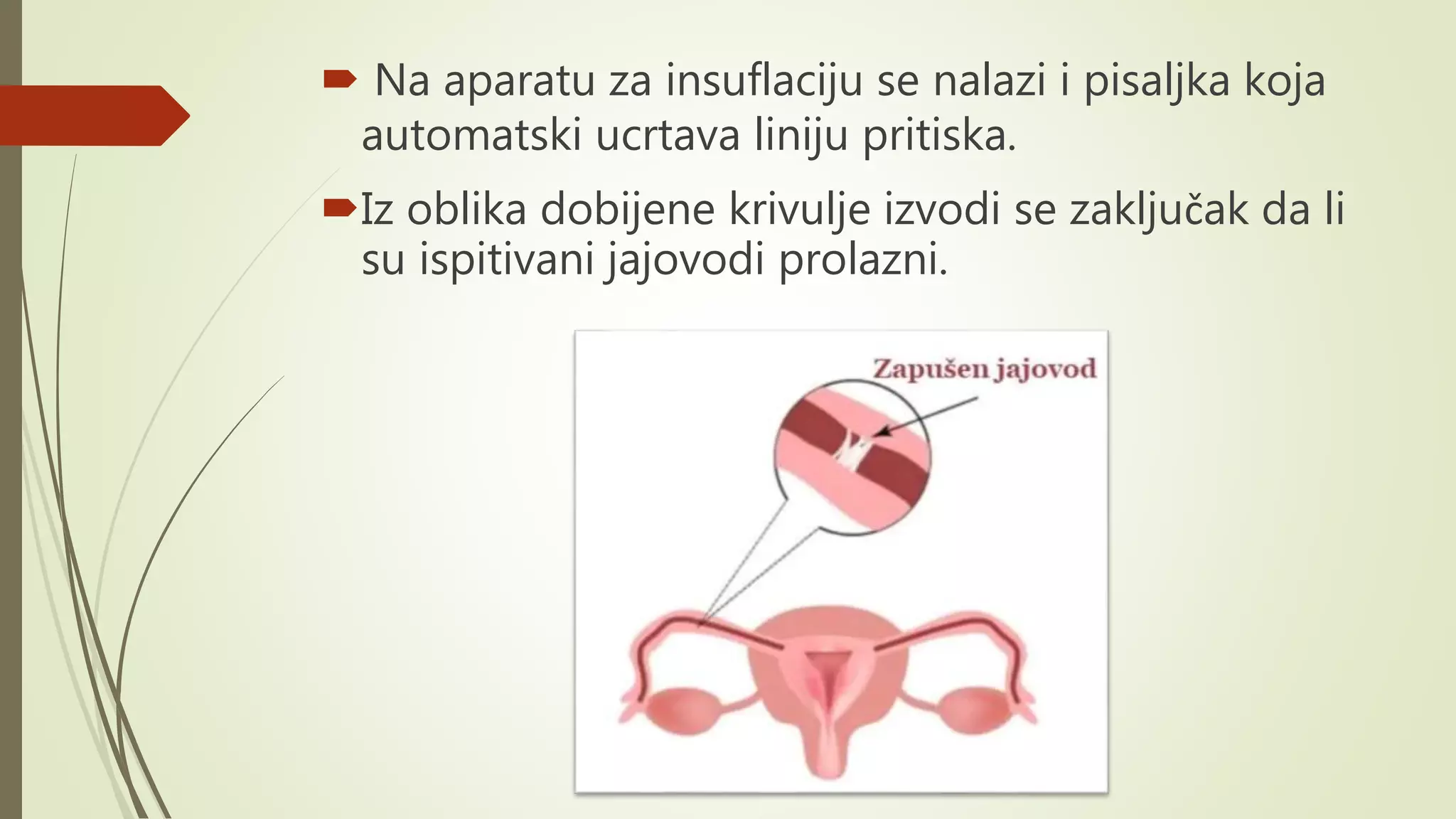 Insuflacija jajovoda | PPTX