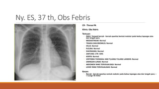 Junaedi-Thorax.pptx