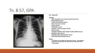 Junaedi-Thorax.pptx
