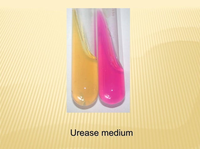 CULTURE MEDIA USED IN MICROBIOLOGY