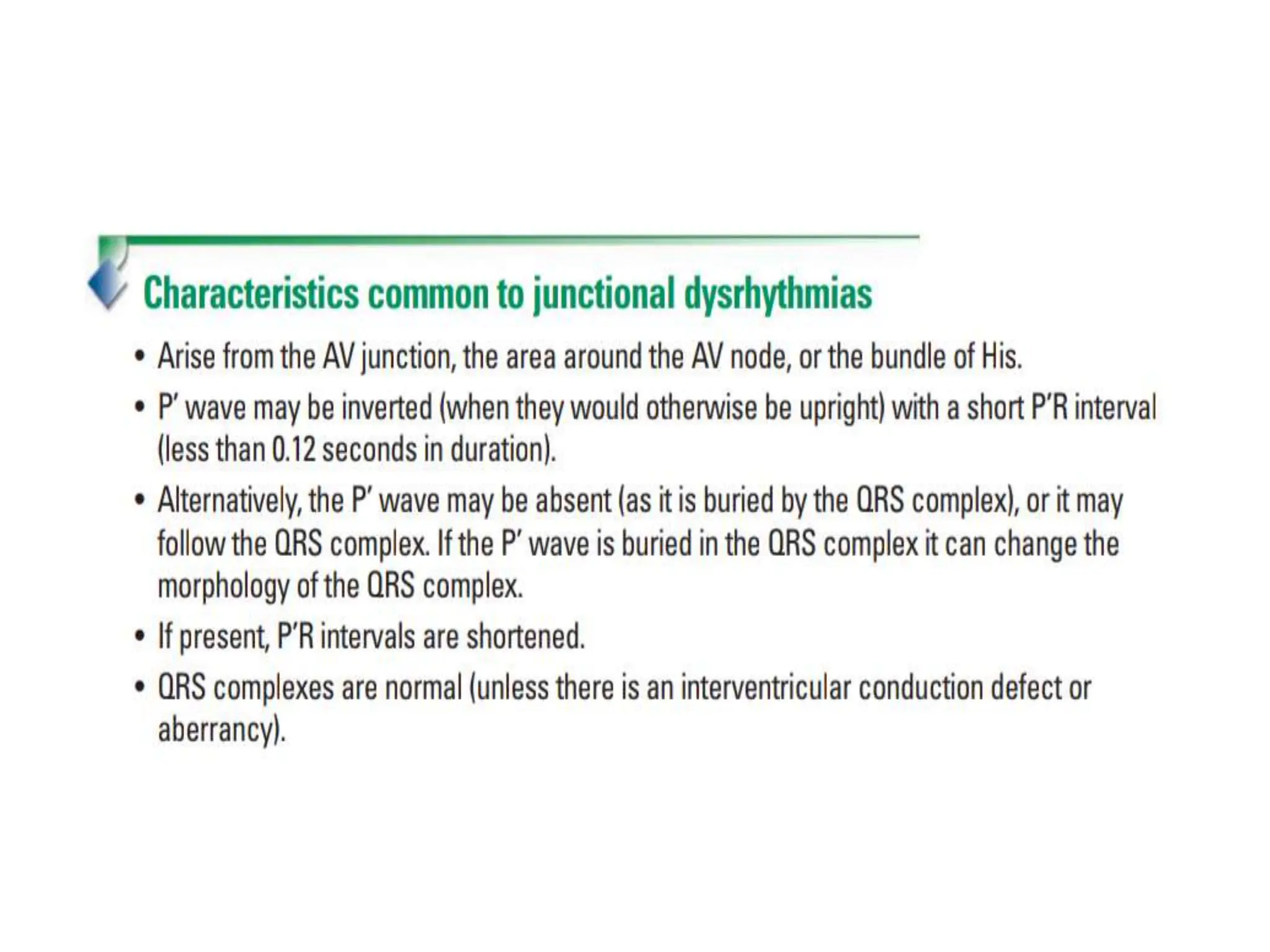 JUNCTIONAL DYSRHYTHMIAS AND HOW TO INTERPRET IN ECG? | PPTX