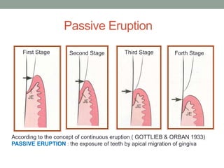 Junctional epithelium | PPTX