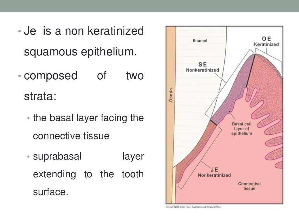 Junctional epithelium