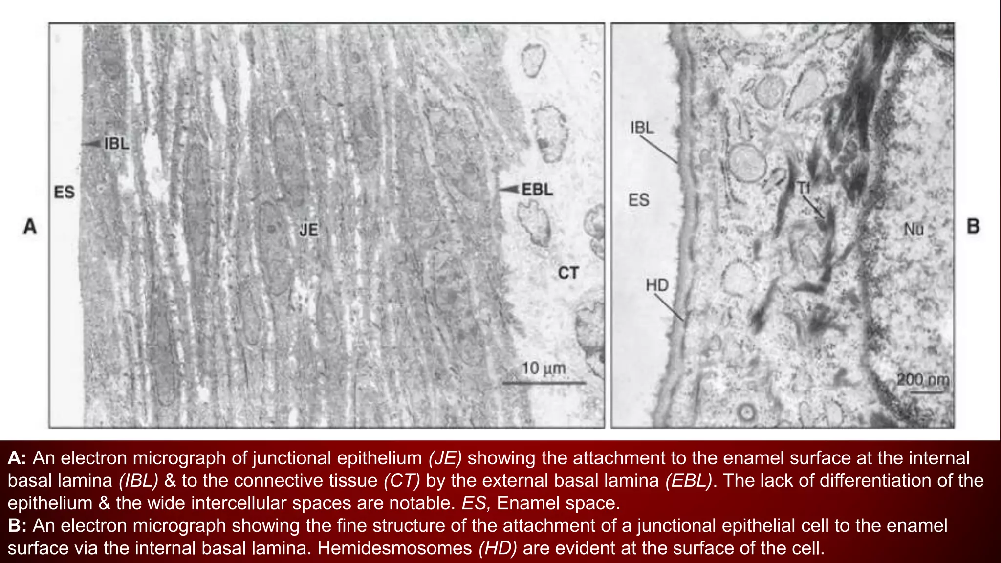 Junctional epithelium | PPTX