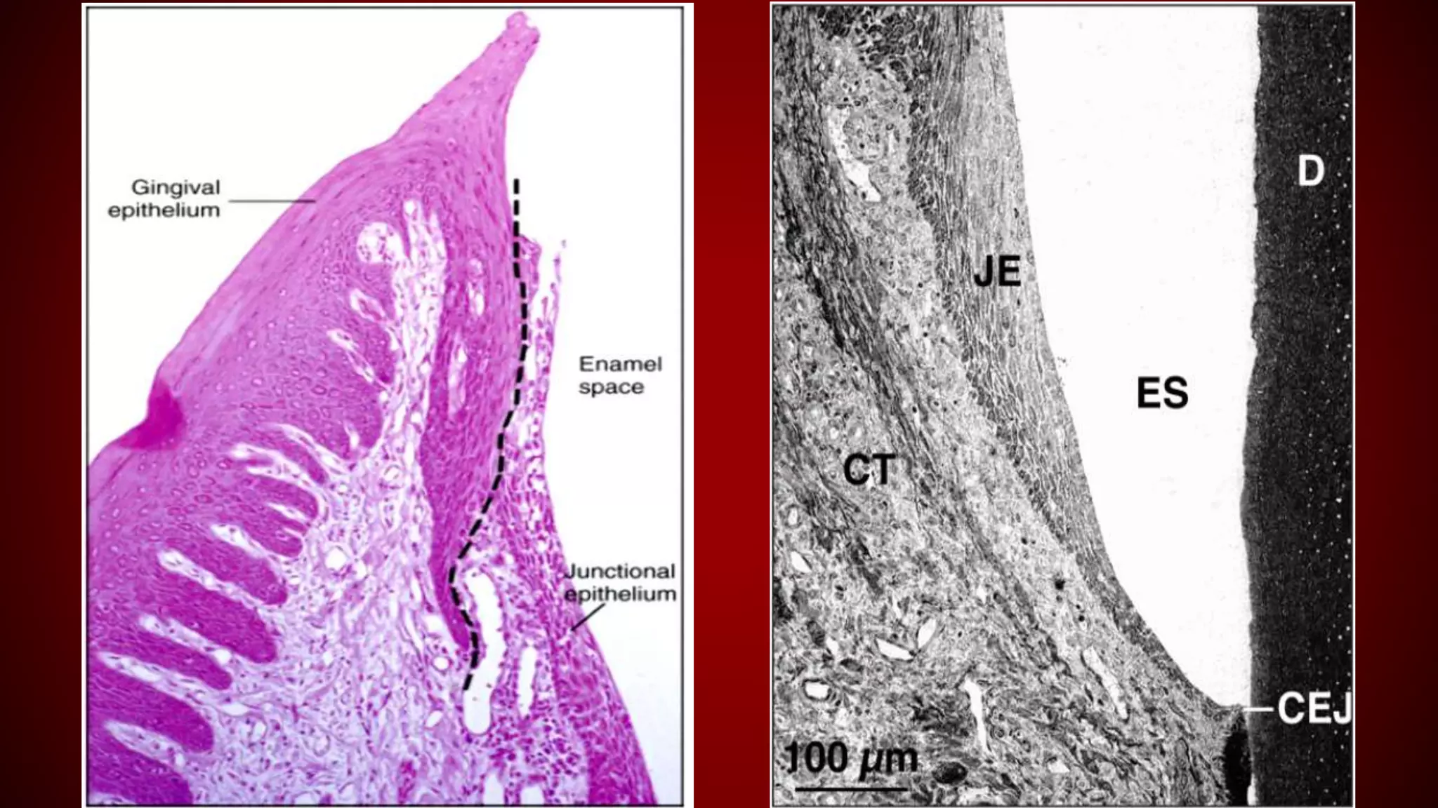 Junctional Epithelium Histology