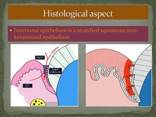 Junctional epithelium | PPTX