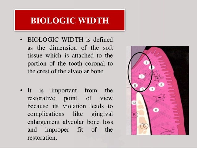 Epithelial Attachment Epithelium Junctional Junctional Cell Junction