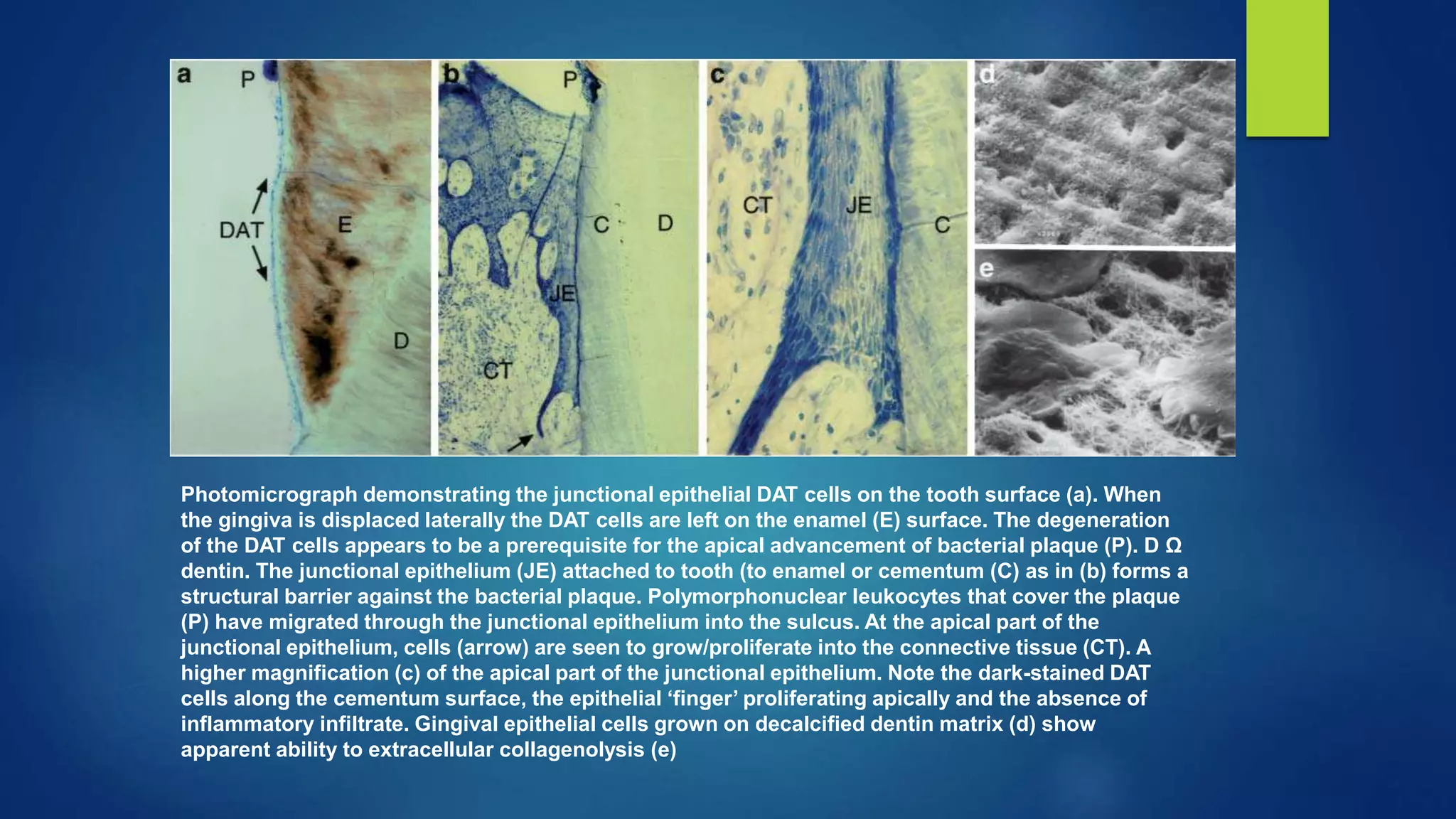 Junctional epithelium | PPTX