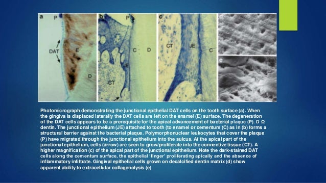 Junctional epithelium