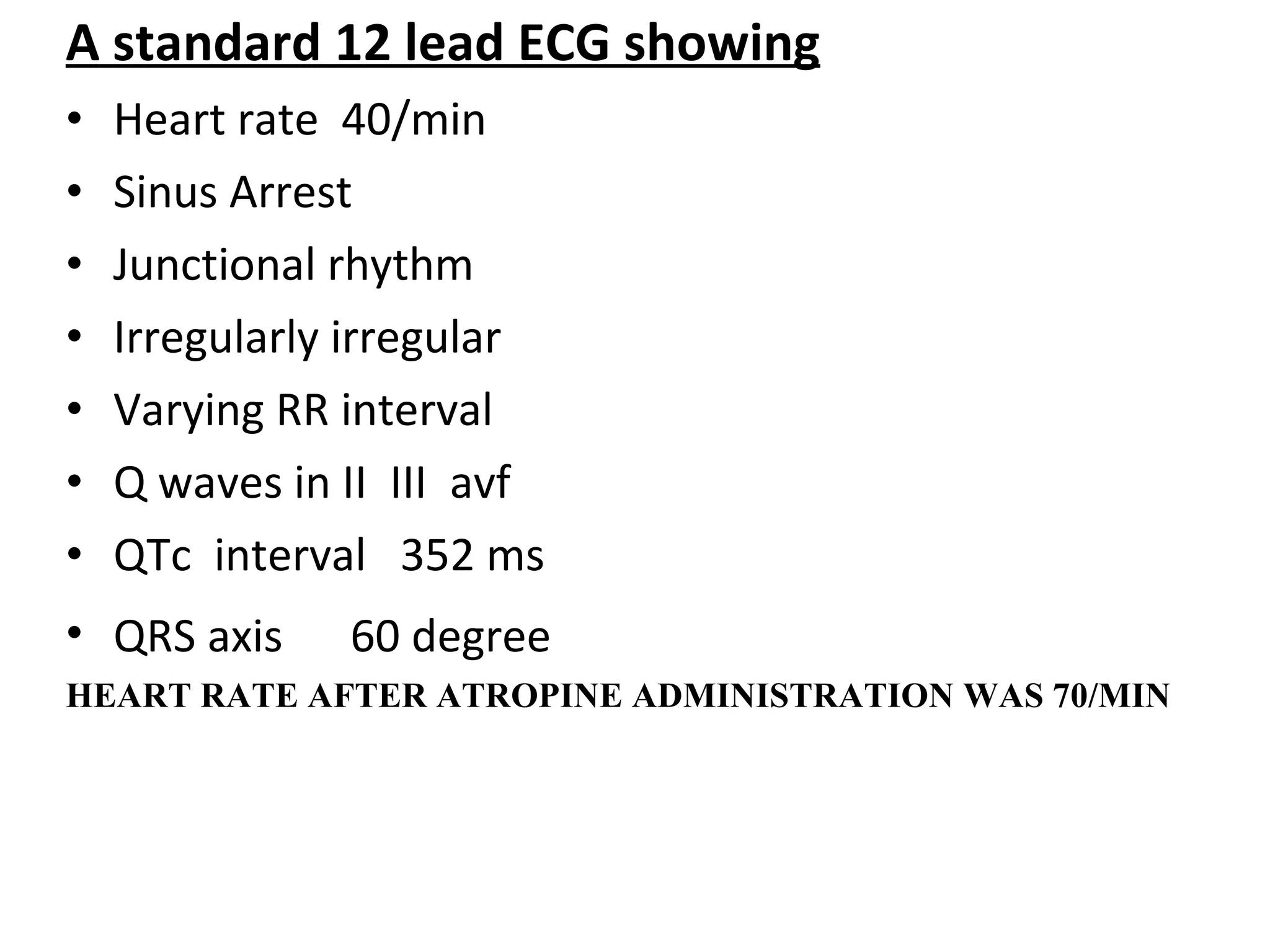 ECG: Junctional Escape Rhythm | PPT