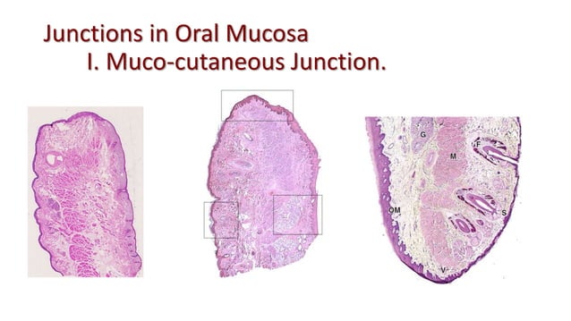 Junctions in oral mucosa | PPTX | Dental Health | Diseases and Conditions