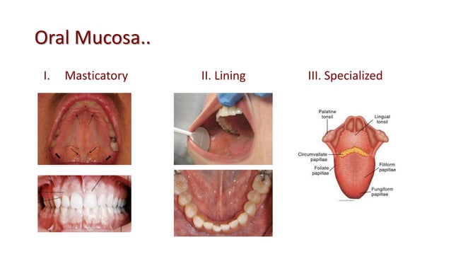 Junctions in oral mucosa | PPTX | Dental Health | Diseases and Conditions