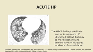 June - Occupational Exposure To Pesticides and Chronic Hypersensitivity ...