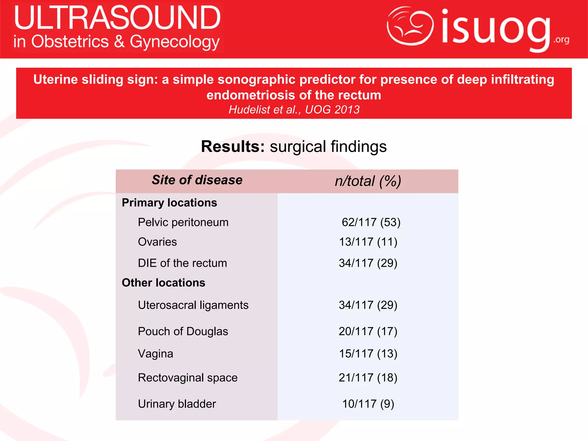 UOG Journal Club: Uterine sliding sign in DIE | PPT