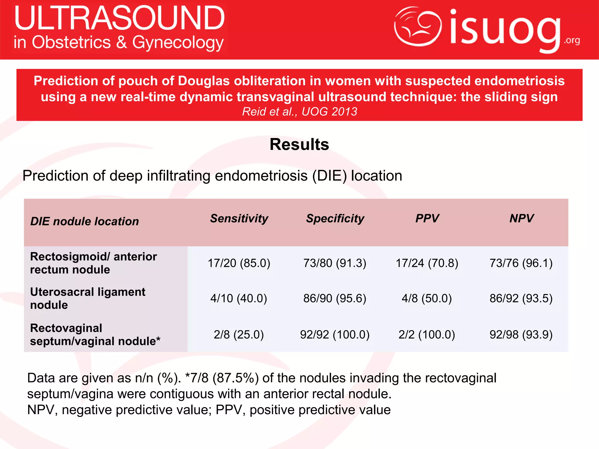 UOG Journal Club: Uterine sliding sign in DIE | PPT