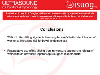 UOG Journal Club: Uterine sliding sign in DIE | PPT