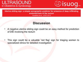 UOG Journal Club: Uterine sliding sign in DIE | PPT