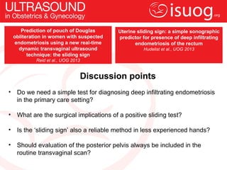UOG Journal Club: Uterine sliding sign in DIE | PPT