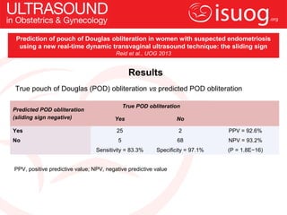 UOG Journal Club: Uterine sliding sign in DIE | PPT