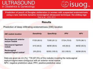 UOG Journal Club: Uterine sliding sign in DIE | PPT