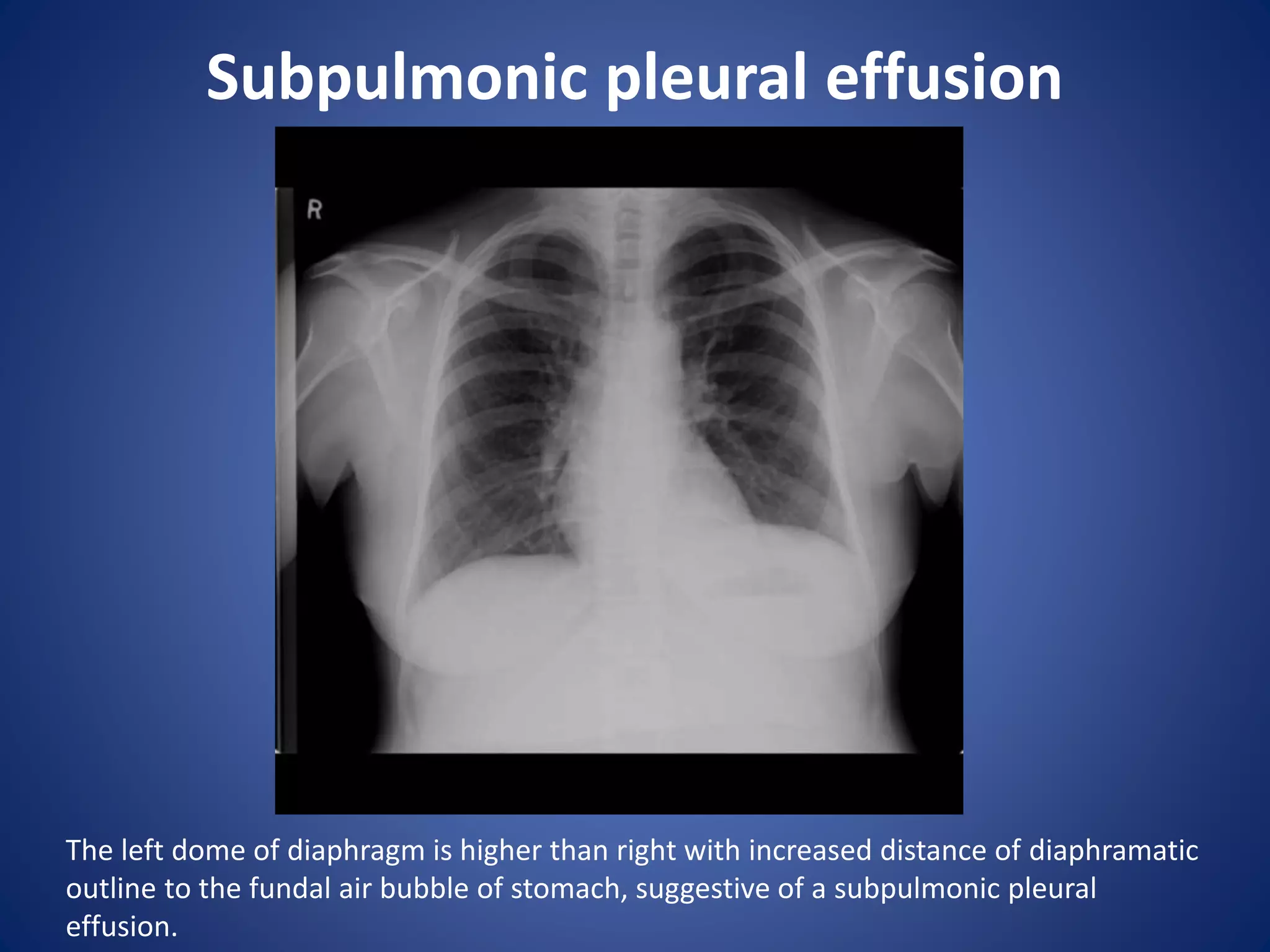 Radiology spotters | PPTX