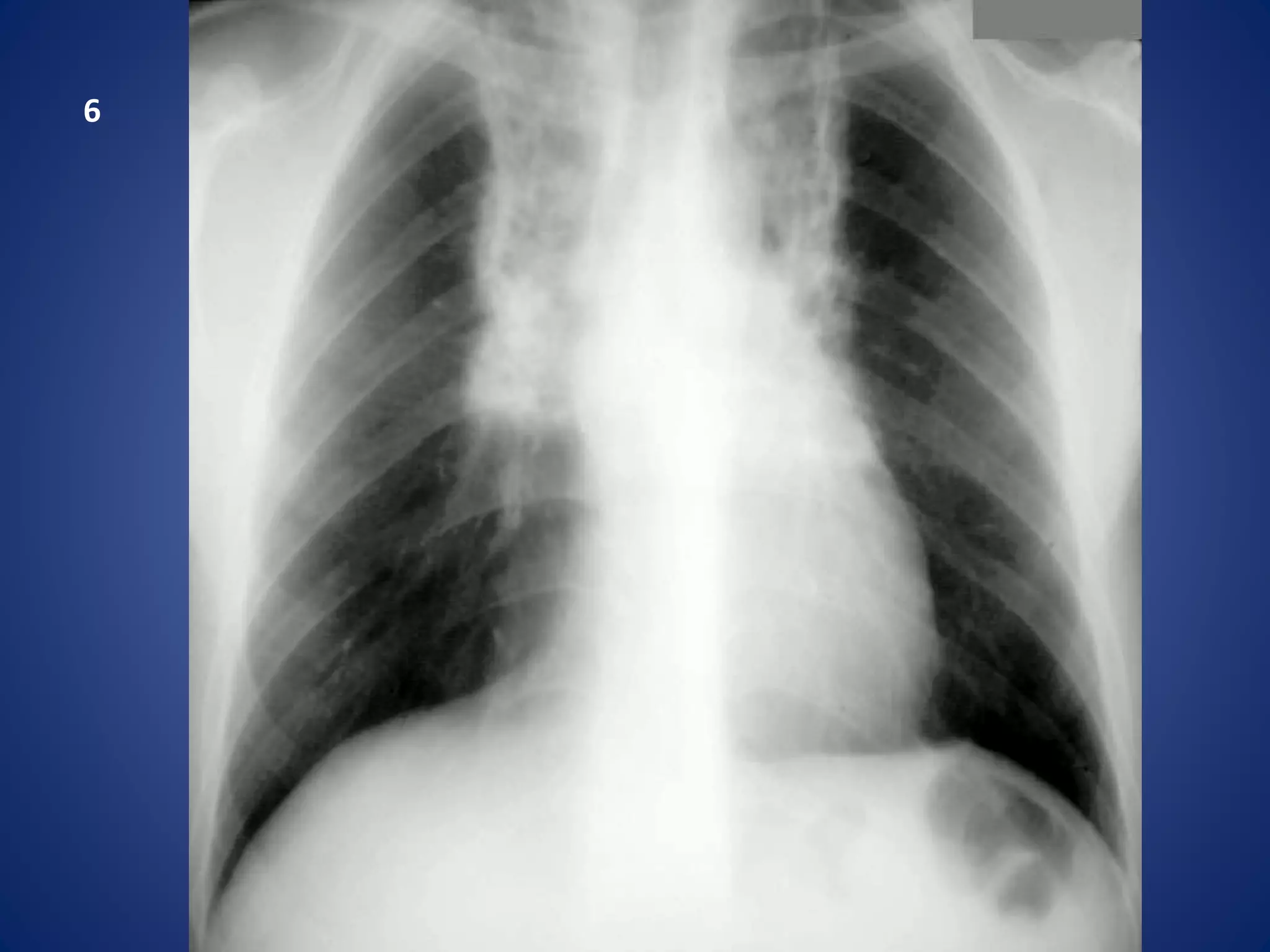 Radiology spotters | PPTX