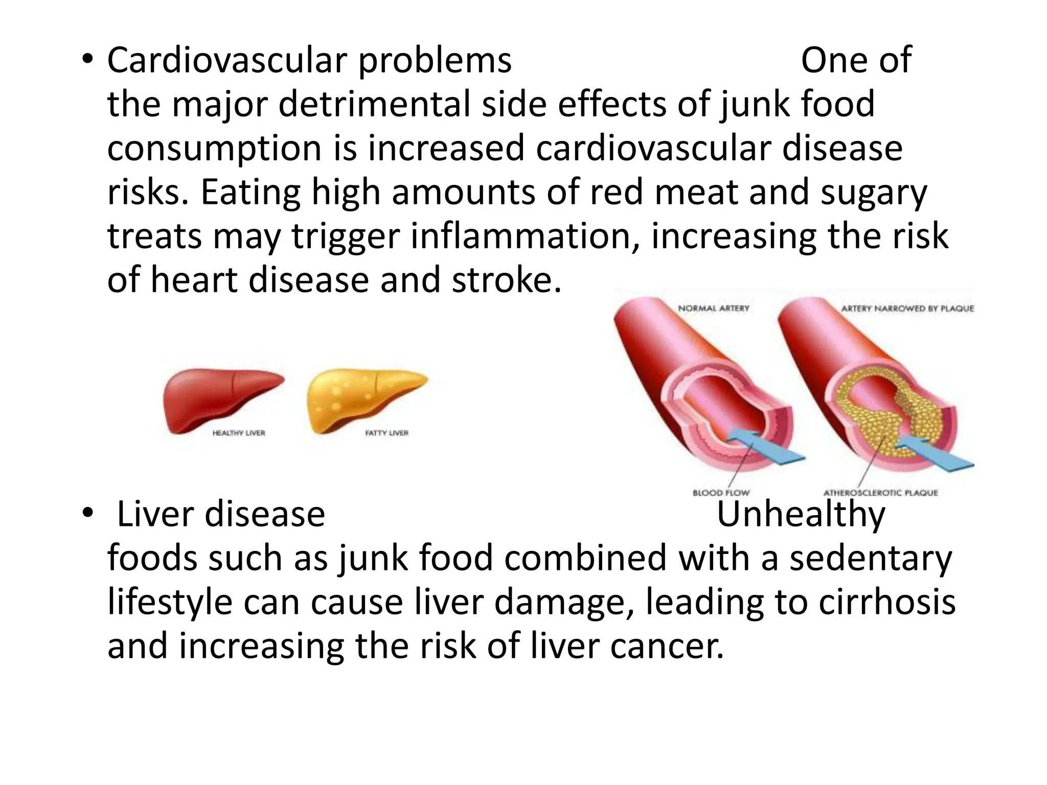 junk food and its side effects and hazards | PPTX