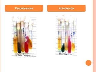 ISOLATION AND IDENTIFICATION OF NLF BACTERIA IN VARIOUS SAMPLES. | PPTX
