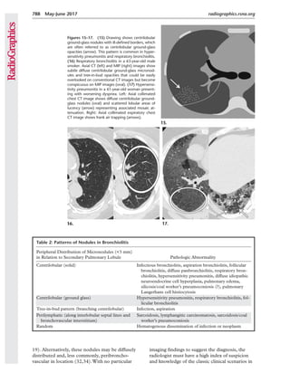 Bronchiolitis : a practice for general radiologists | PDF