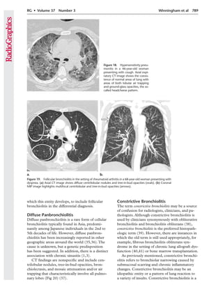 Bronchiolitis : a practice for general radiologists | PDF