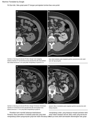 Jurnal Dani BAtu Ginjal pada CT Scan dengan kontras .pdf