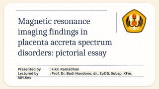 Placenta Accreta Spectrum imaging MRI.pptx