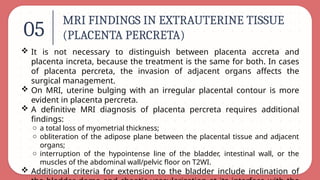 Placenta Accreta Spectrum imaging MRI.pptx