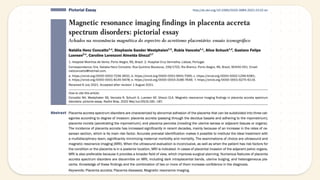 Placenta Accreta Spectrum imaging MRI.pptx