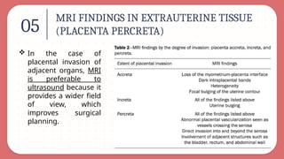 Placenta Accreta Spectrum imaging MRI.pptx