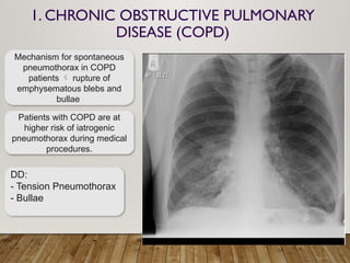jurnal pneumothorax Radiologi Presentation .pptx