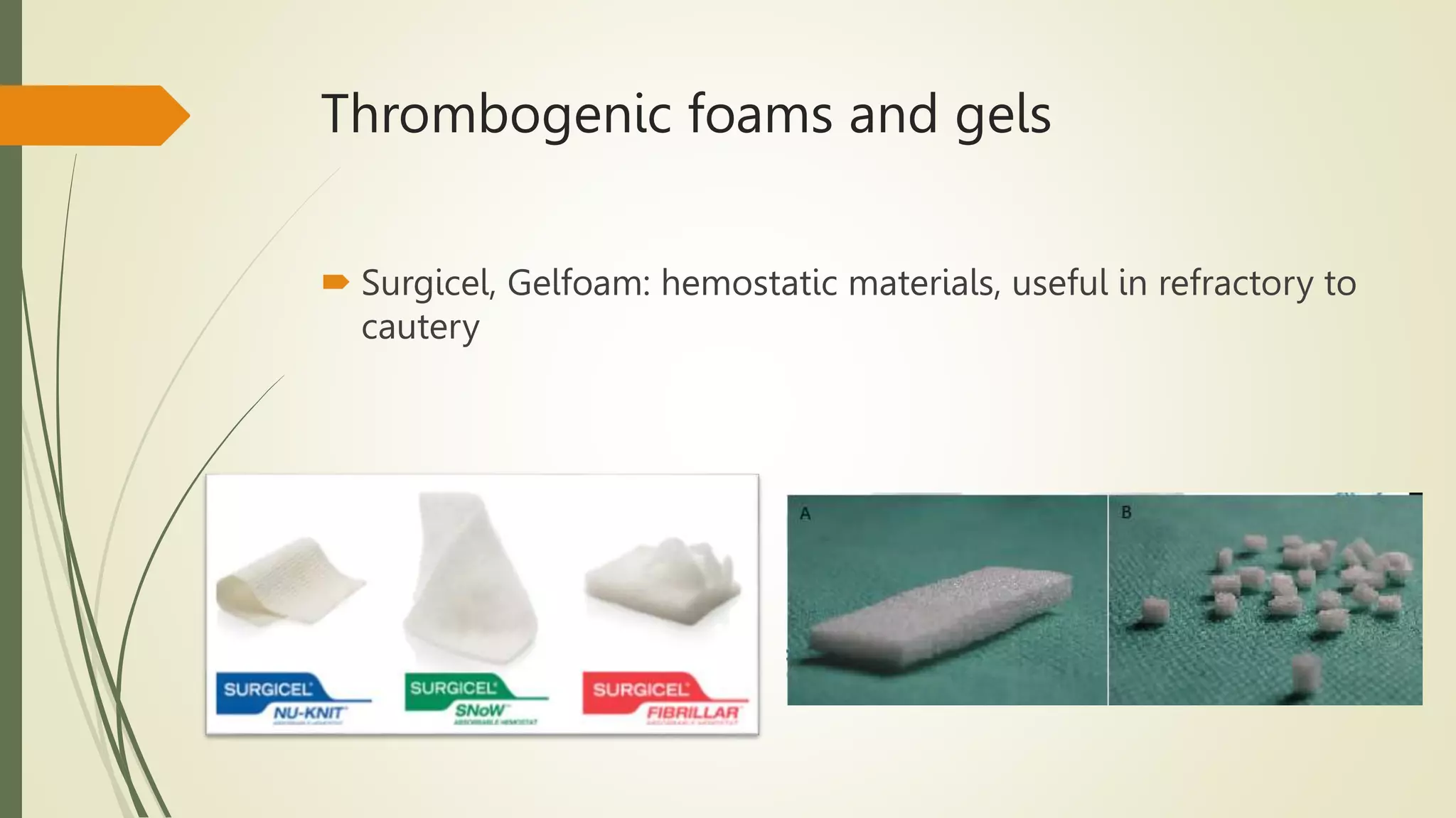 Epistaxis treatment | PPTX