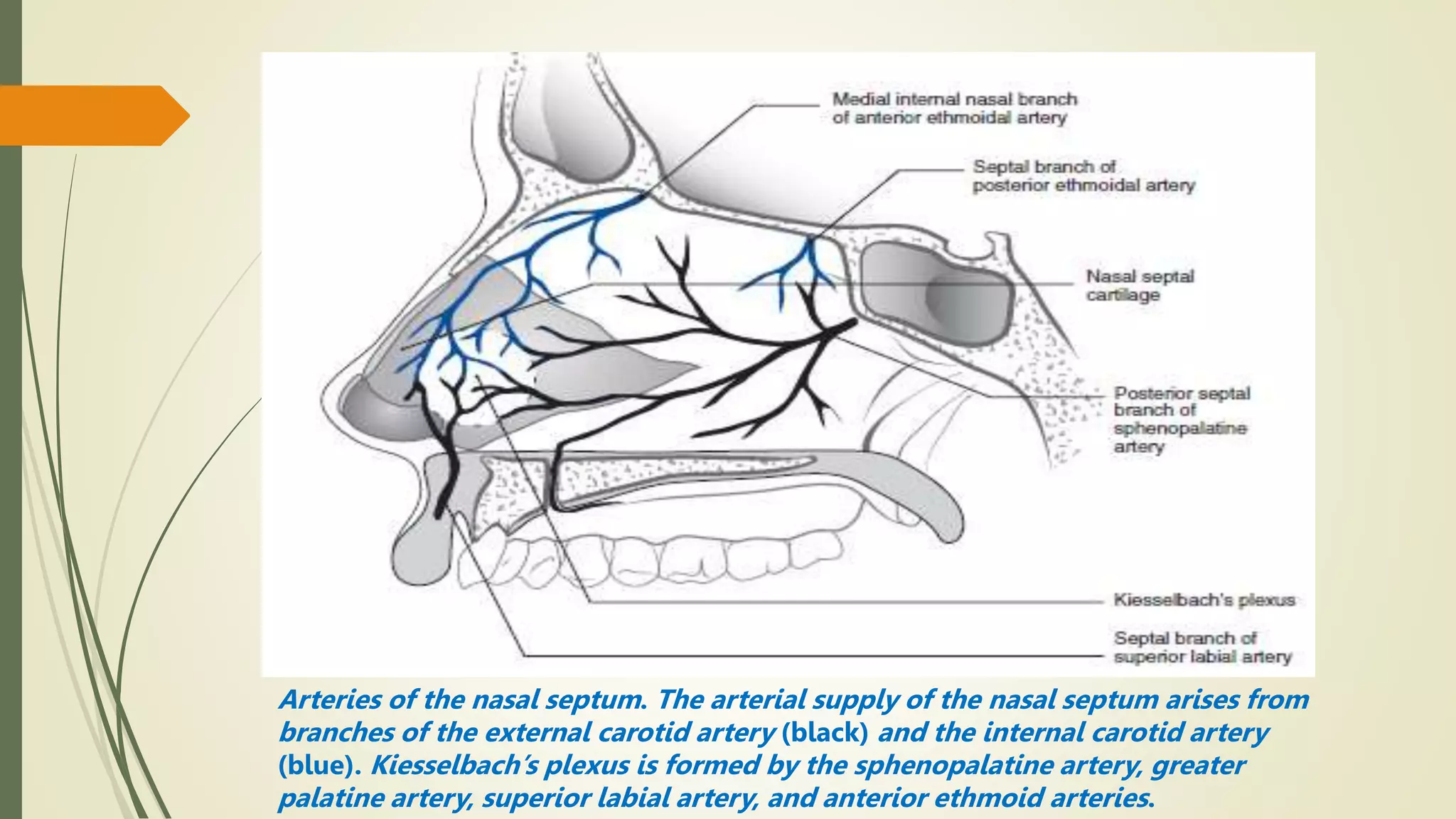 Epistaxis treatment | PPTX