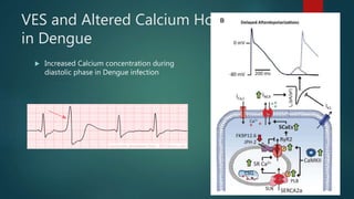 Cardiac Manifestation in Dengue Infection | PPTX