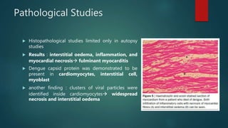 Cardiac Manifestation in Dengue Infection | PPTX