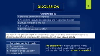 JURNAL READING Lucio Phenomenon (Sequelae of Neglected leprosy) JURNAL ...