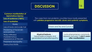 JURNAL READING Lucio Phenomenon (Sequelae of Neglected leprosy) JURNAL ...