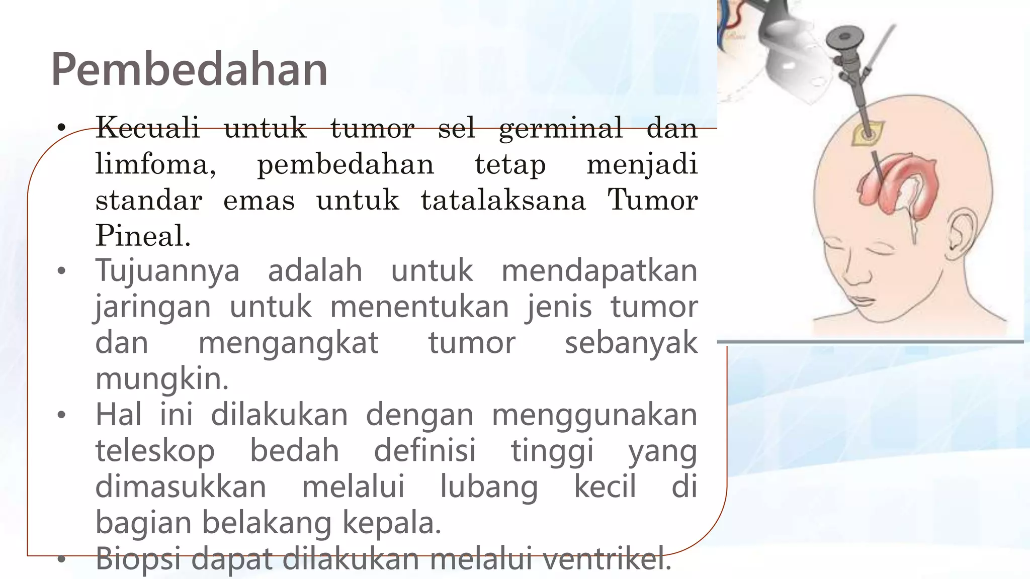 Jurnal Reading Neuro Onkologi Rosyita.pptx