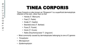 Jurnal Tinea Corporis.pptx