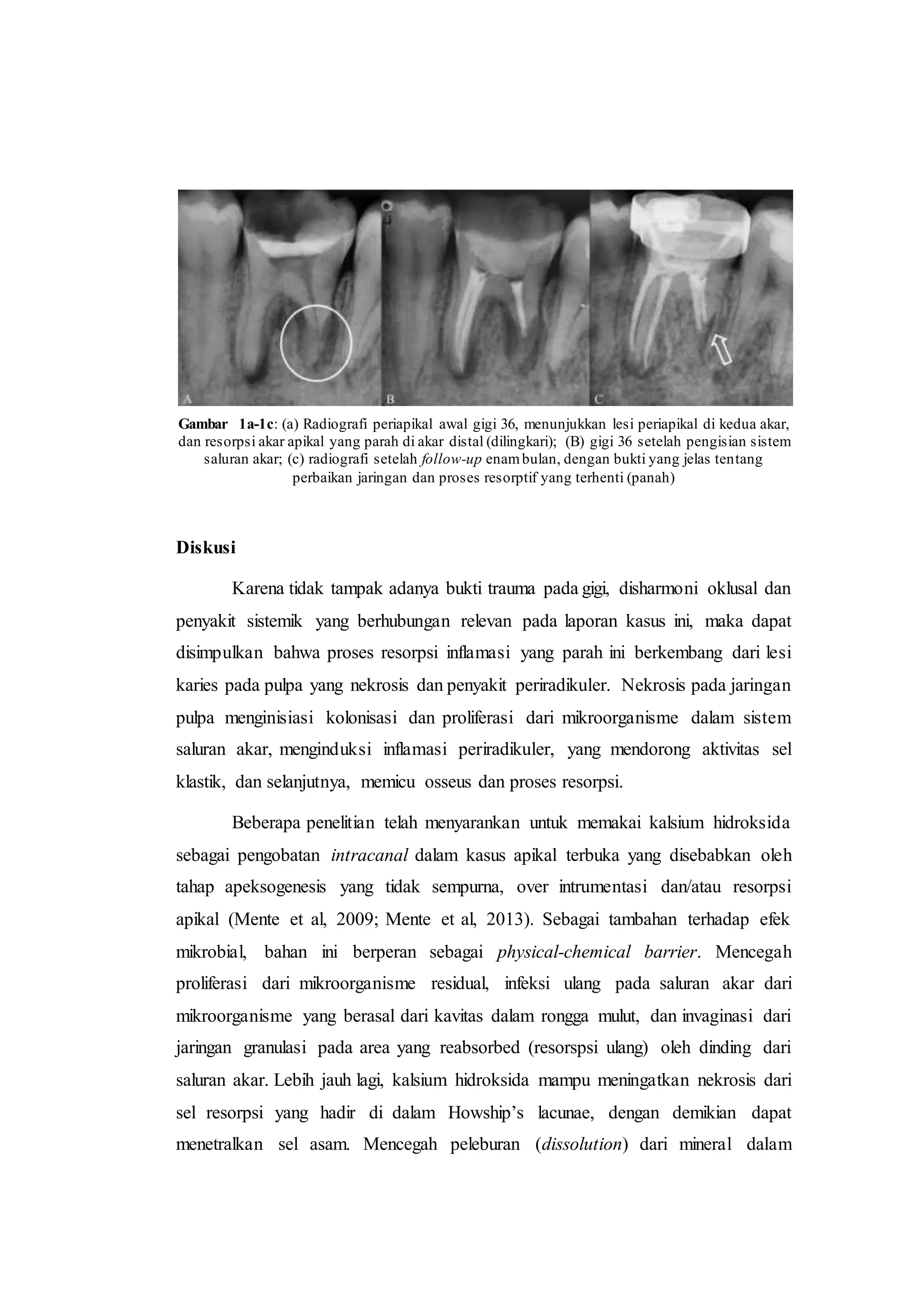 Jurnal tutor nekrosis | DOCX