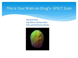 "Just Take the Darn Med's"- Understanding Patient Non-Compliance to ...