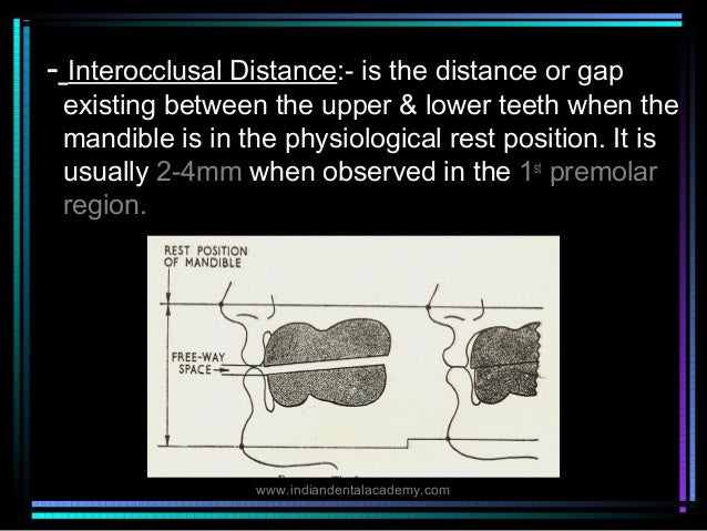 vertical jaw relationships / dental implant courses by Indian dental
